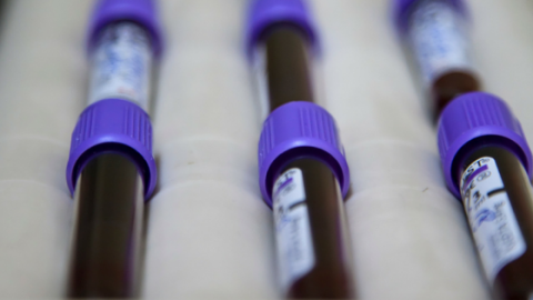 How Cells4Life Send Your Cord Blood Sample to the Laboratory | MedCells ...