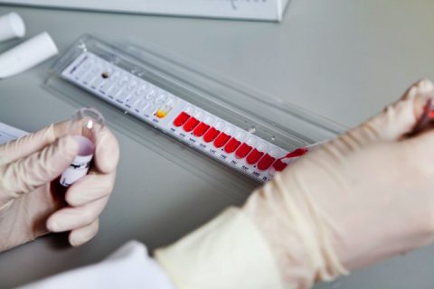 What is HLA Tissue Typing & Why is it important? | MedCells Cord Blood ...