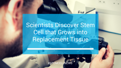 Scientists Discover Stem Cell that Grows into Replacement Tissue ...
